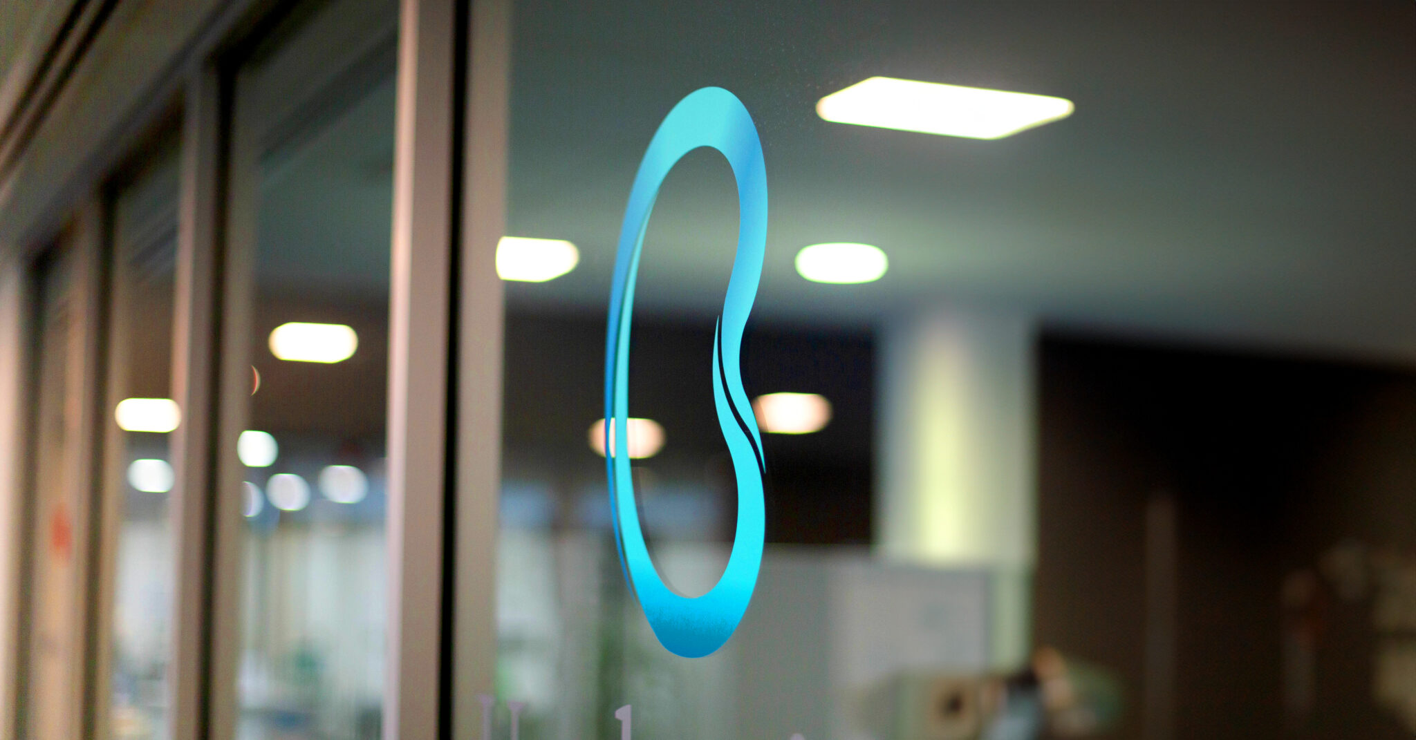 Treatment of Ureteric & Kidney Stones (Ureteroscopy / Pyeloscopy ...